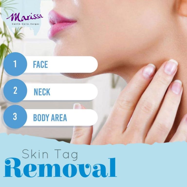 Milia & Skintag 2024 – Dr Marissa Face Expert